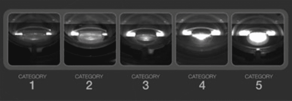 LENSAR - Adaptability